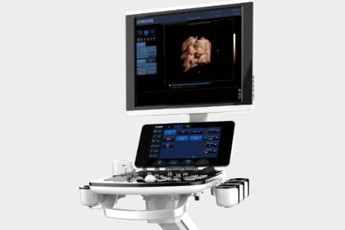 Chison CBit 8 | Ortner Medizintechnik